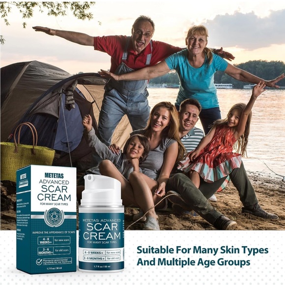 Other | Scar Cream | Poshmark